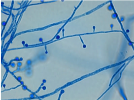 Blastomyces species | FOAMid